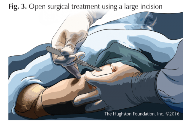 Wellness at Hughston Articles | Hughston Clinic Nashville